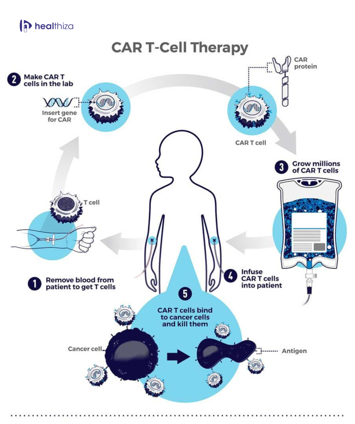 Can CAR-T Cell Therapy Cure Cancer?